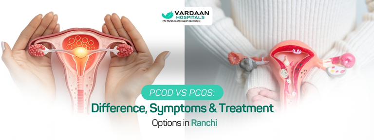 PCOD vs PCOS: Differences, Symptoms & Treatment in Ranchi